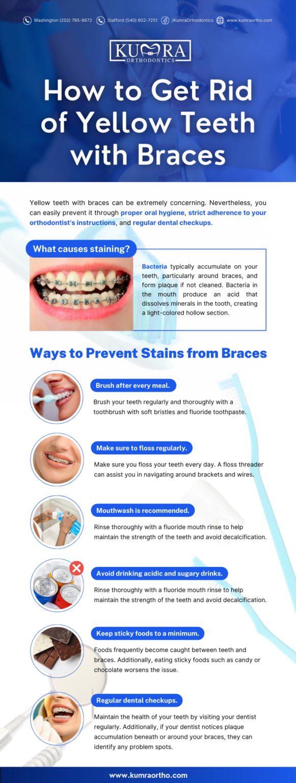 How to Get Rid of Yellow Teeth with Braces | Kumra Orthodontics