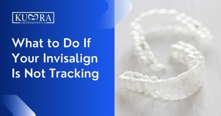 What to Do If Your Invisalign Is Not Tracking | Kumra Orthodontics