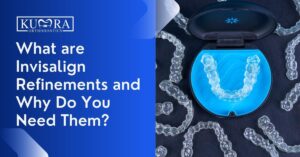 What are Invisalign Refinements and Why Do You Need Them? | Kumra ...