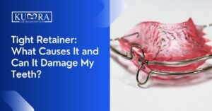 Tight Retainer: What Causes It and Can It Damage My Teeth? | Kumra ...