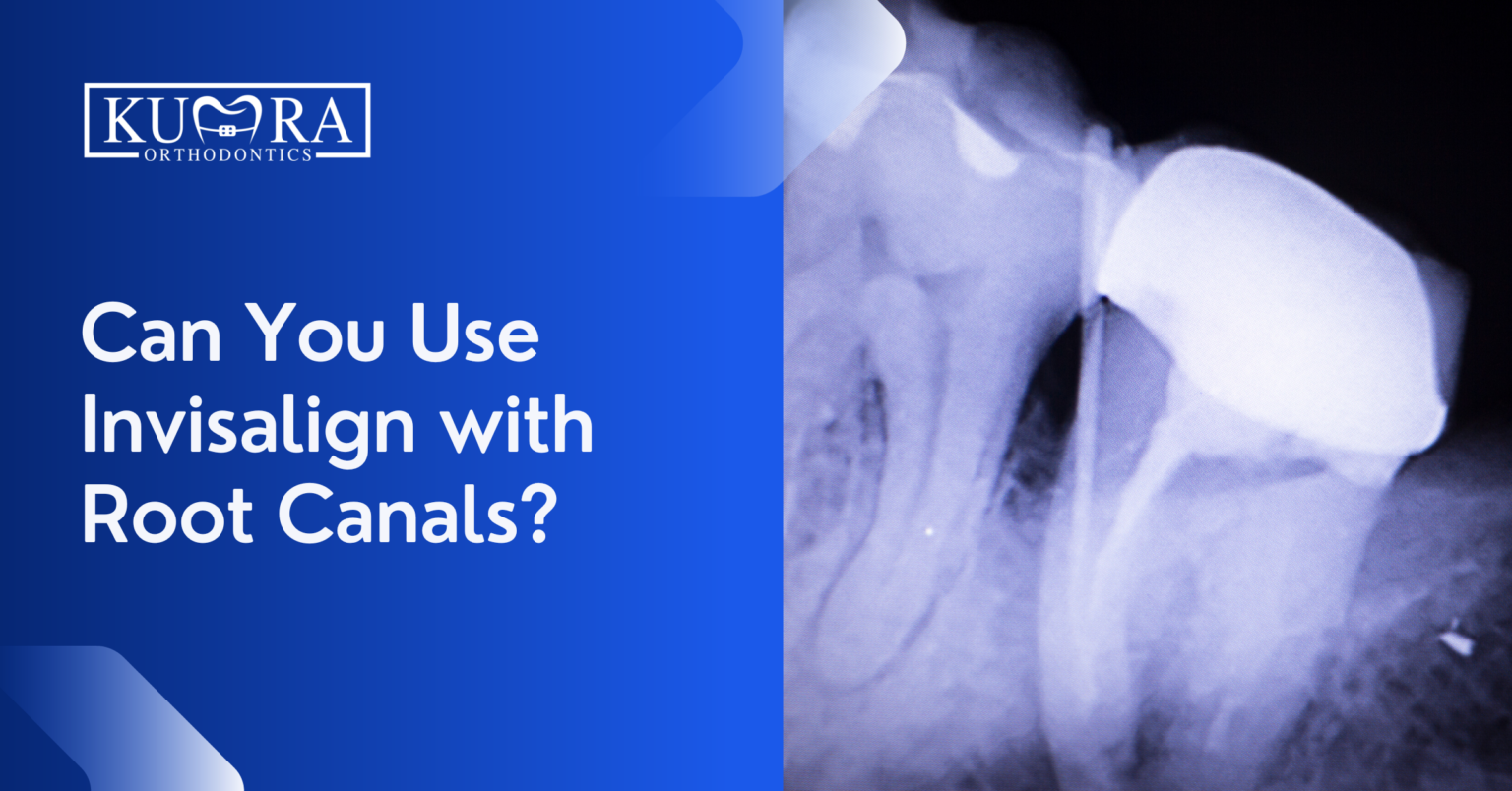 Can You Use Invisalign with Root Canals? | Kumra Orthodontics